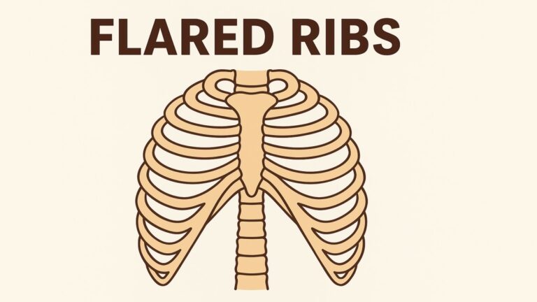 Flared Ribs: Causes, Symptoms, Treatment, and Prevention - Gessolini